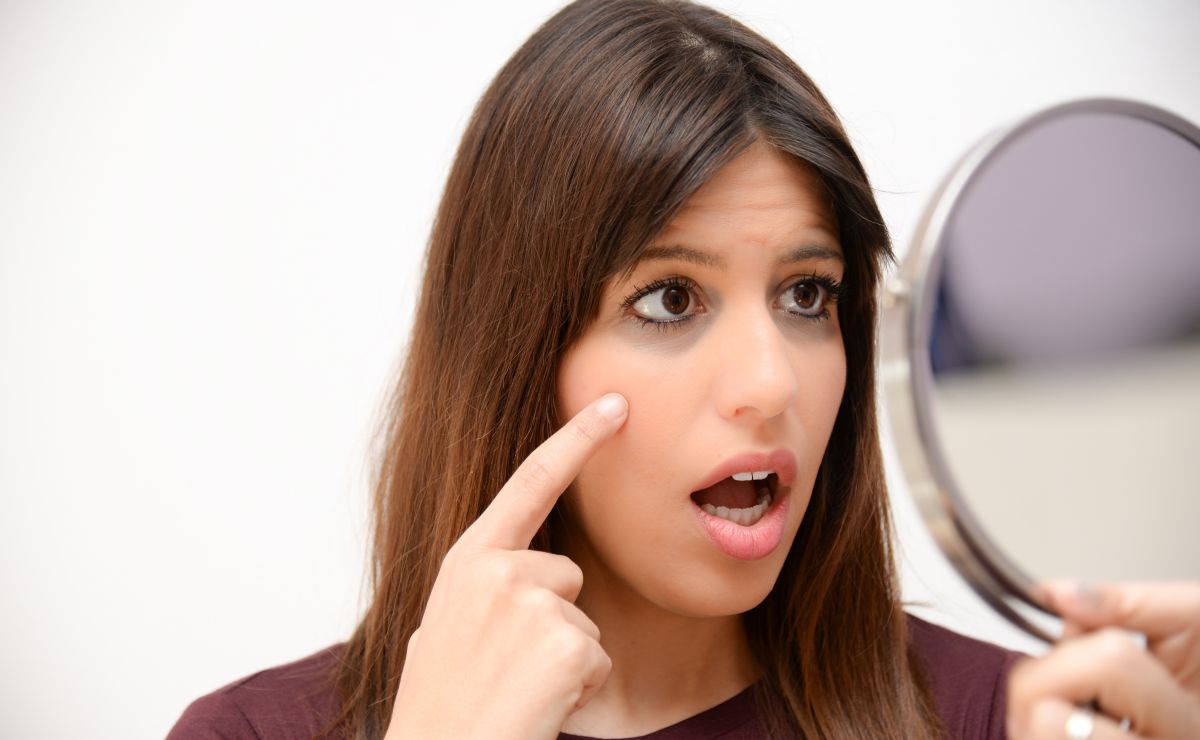 Ojeras oscuras: cómo usar el aloe vera y la vitamina E para disminuir ...