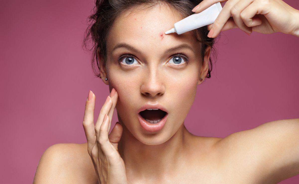 Espinillas en el rostro: 6 cremas que puedes usar para combatirlas ...