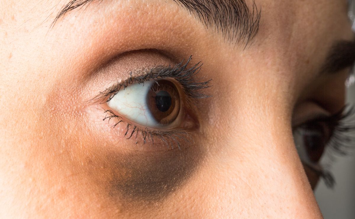 Ojeras muy oscuras: cómo cubrirlas con maquillaje - Bien Bonita