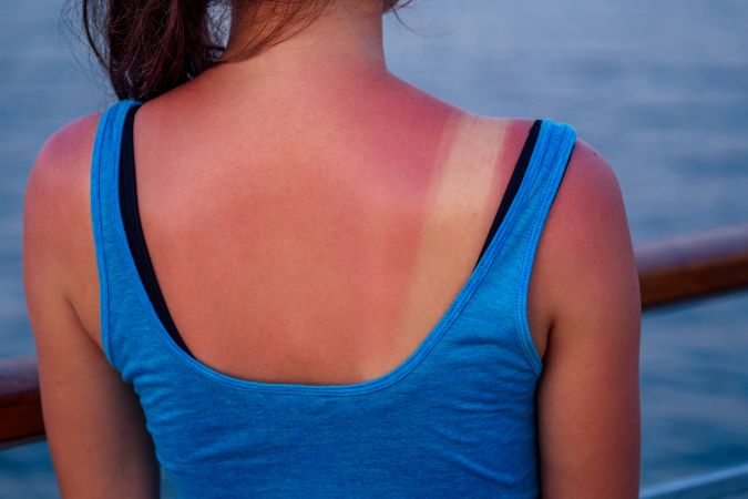 Cuáles son las consecuencias de usar camas de bronceado en tu piel ...